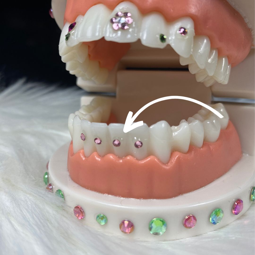 Kit de strass dentaire à poser à la maison : dents du bas
